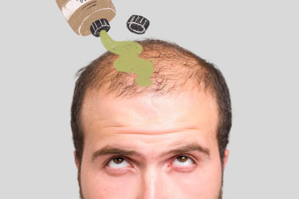 UCLA Scientists Develop Topical Cream That Regrows Hair in Just One Week